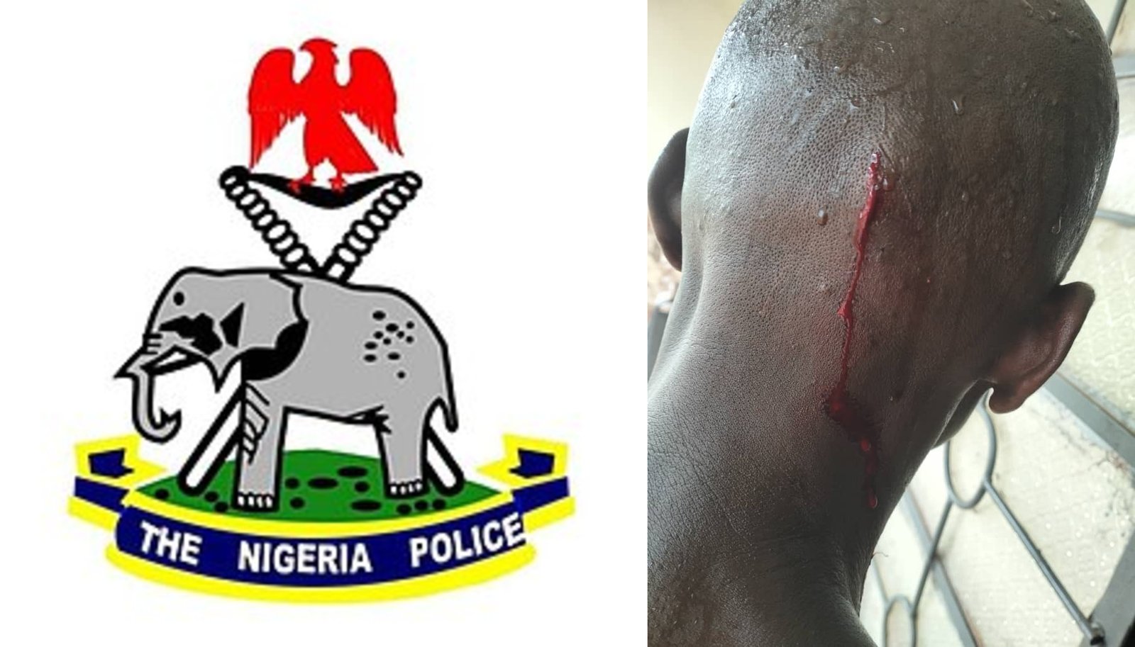 BREAKING: JED PLC Condemns Police Brutality on Staff – NV News